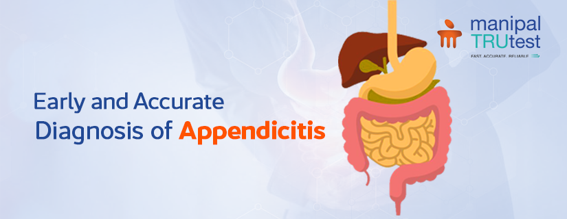 Early and Accurate Diagnosis of Appendicitis | Manipal TRUtest