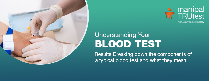 Understanding Your Blood Test Results: Breaking Down The Components Of ...