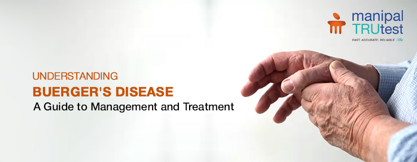 Understanding Buerger's Disease: A Guide to Management and Treatment ...