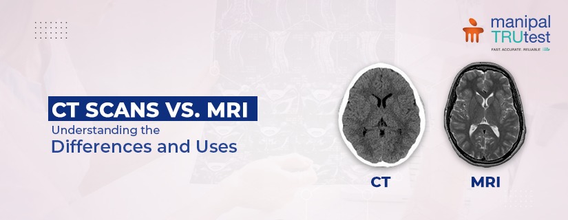 CT Scans vs. MRI: Understanding the Differences and Uses | Manipal TRUtest