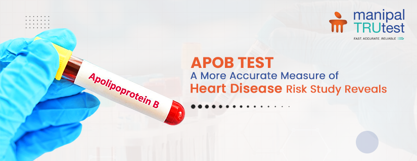 ApoB Test: A More Accurate Measure of Heart Disease Risk, Study Reveals ...