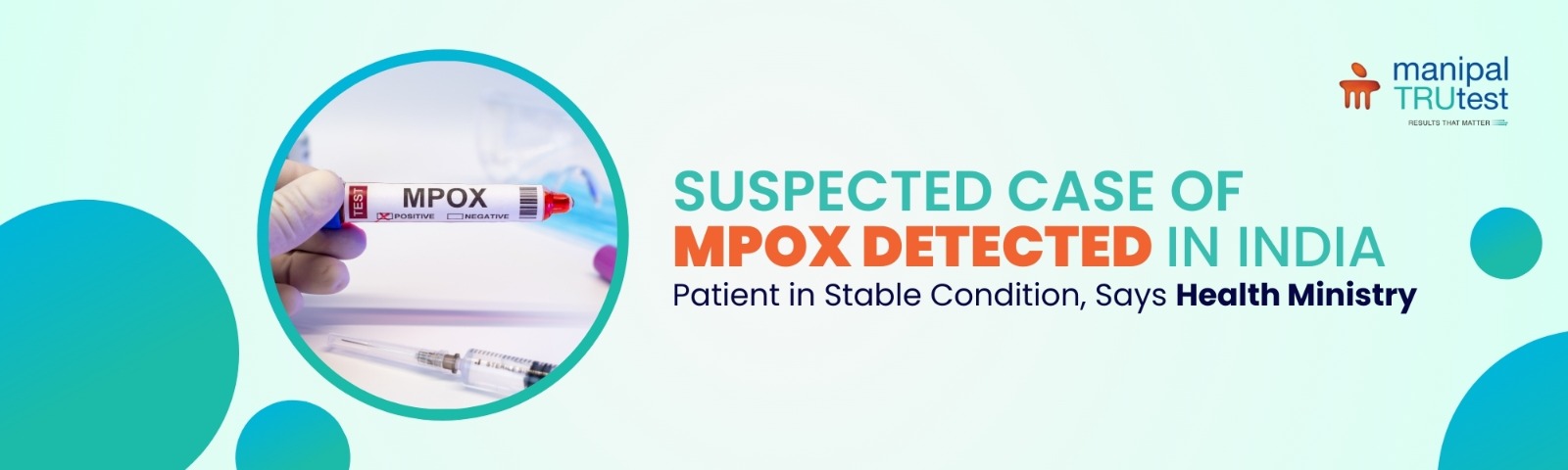 Suspected Case of Mpox Detected in India: Patient in Stable Condition ...